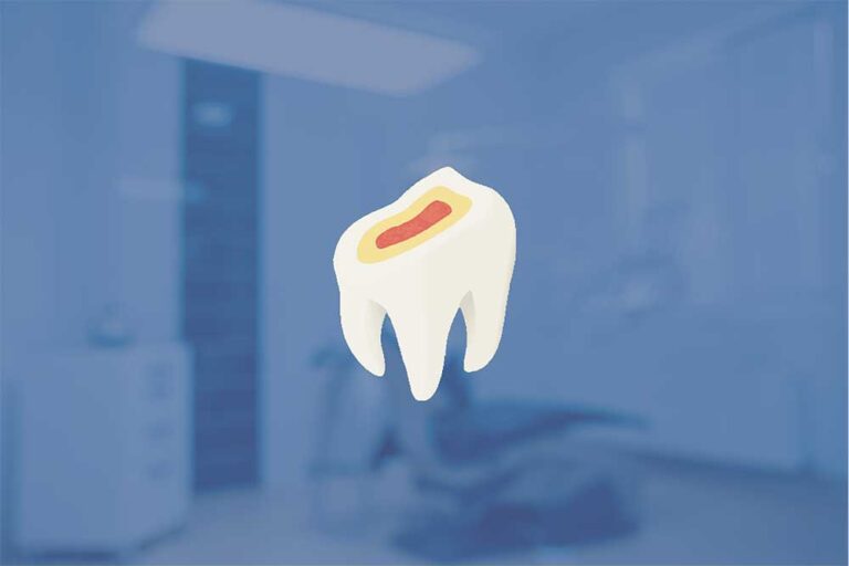What are teeth made of? (The four layers of tissue that make your teeth ...