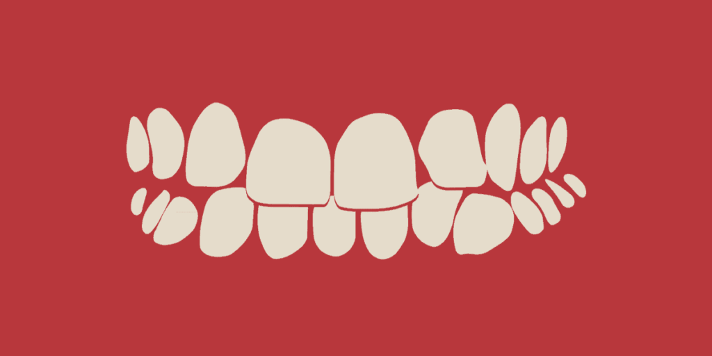 How to fix crooked teeth (everything you need to know) - Wahroonga Dental