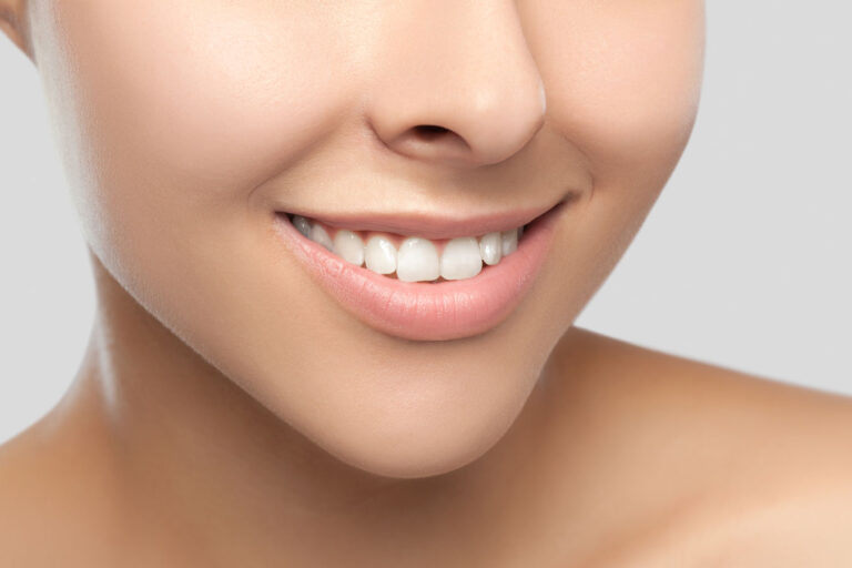 Cosmetic Contouring - Wahroonga Dental